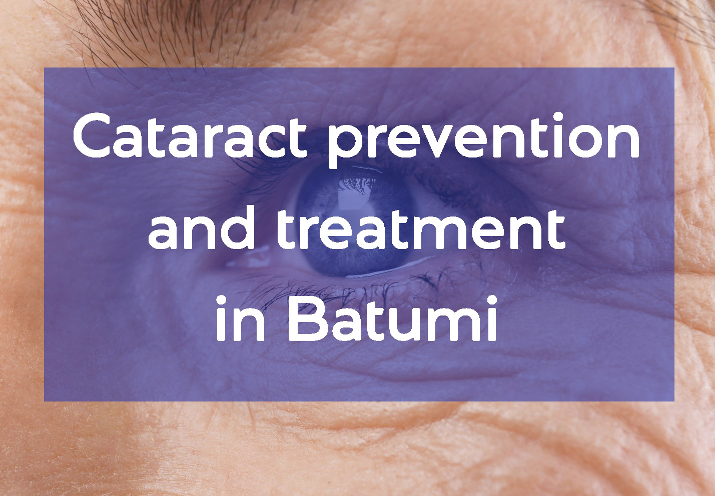 Cataract prevention and treatment options: myths and reality ...
